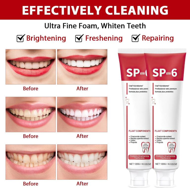 teeth whitening gh - OrthoHub